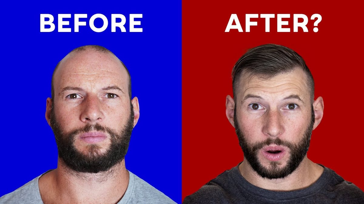 Currentbody Hair Regrowth Before And After Surprise