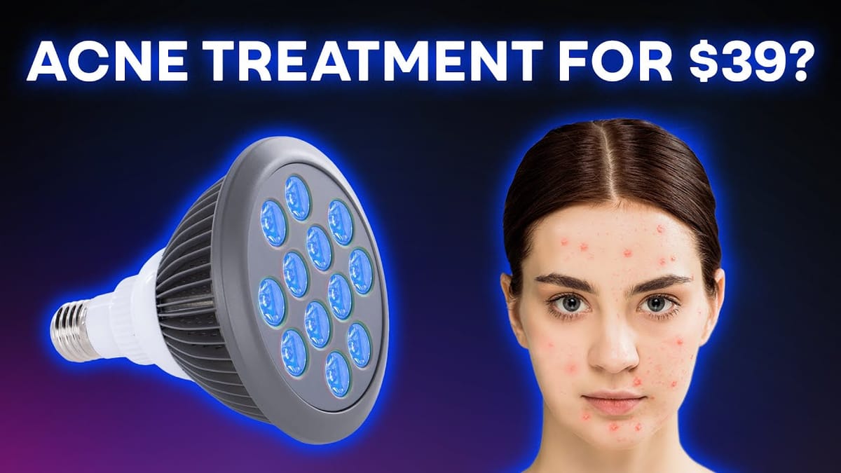 Hooga Blue Light Therapy Review: Handheld Acne Buster?